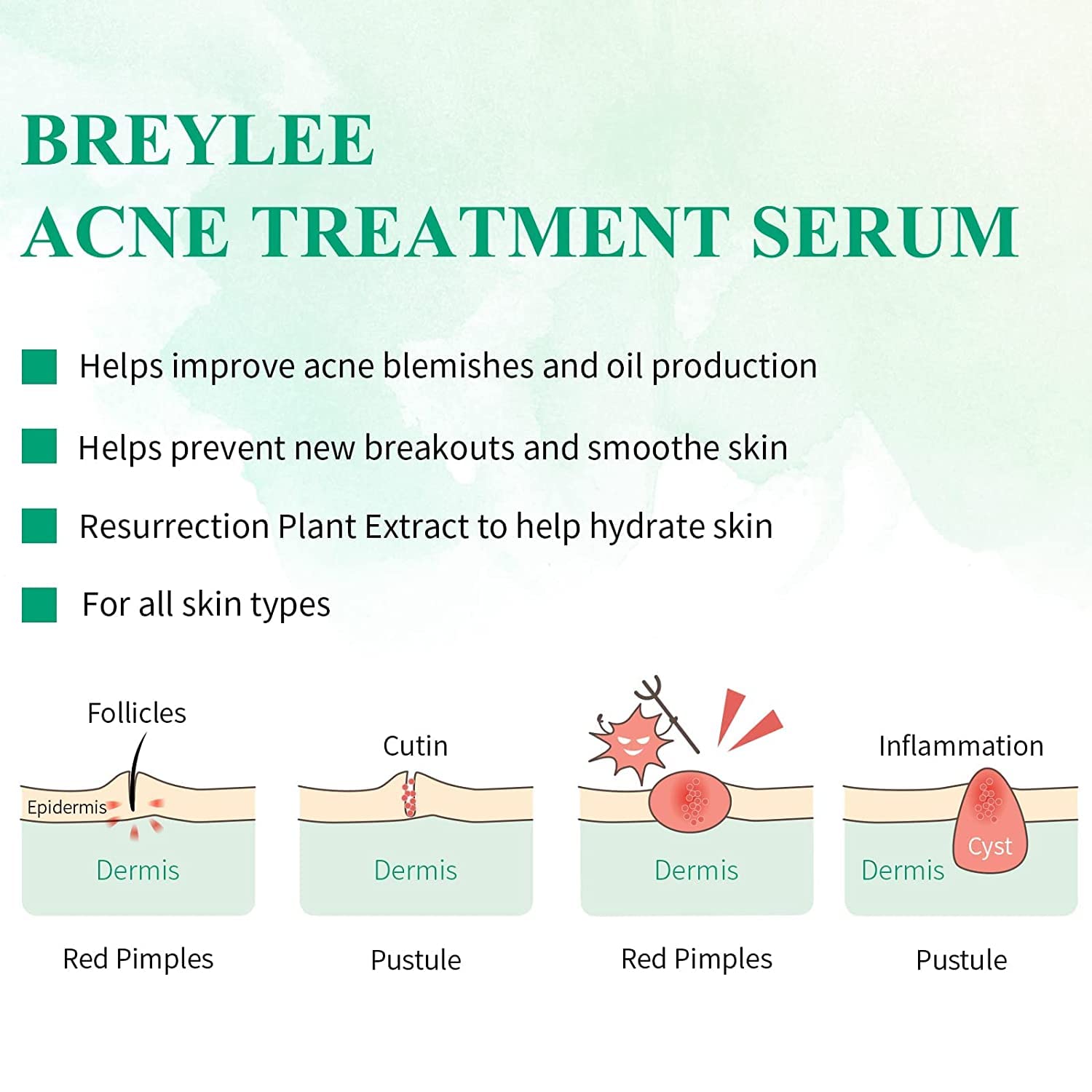 Tea Tree Oil Acne Serum, BREYLEE 2.0 Treatment Acne-Prone Sensitive Skin Care Face Serum to Cystic Acne Scars, Redness Relief, Pimples Dark Spots Remove, Niacinamide Facial Moisturizer,30ml/1.01fl oz