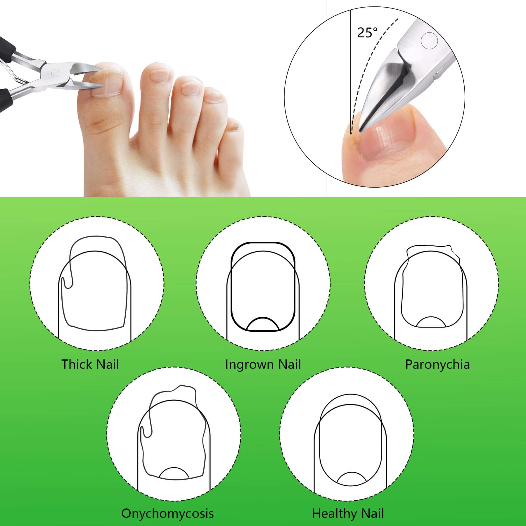 Feiccier Heavy Duty Ingrown Toenail Clippers, Professional Toenails Trimmer, Podiatrist Toe Nail Clippers for Thick Nail & Ingrown Toenails, Sharp Curved Blade, Pedicure Tools.