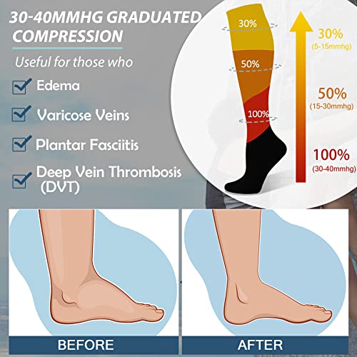 FULLSOFT Medical Graduated 30-40mmHg Compression Socks for Women&Men Circulation Knee High Socks Hiking Running Nursing Stockings(S,White)