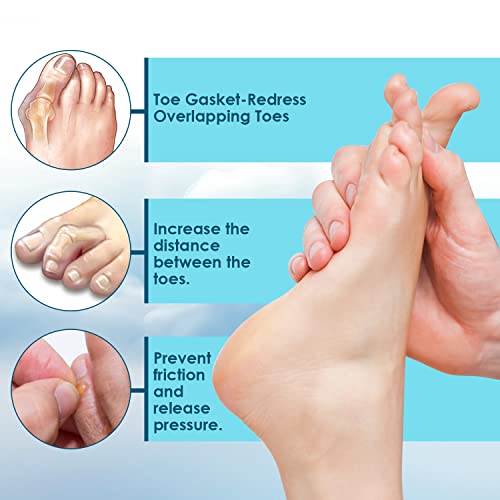 Kimihome 12 Packs Foam Toe Separator,Toe Gasket-Redress Overlapping Toes, Prevent Friction and Release Pressure, Relieve The Pain Caused by Bunions