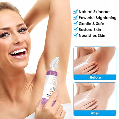 H-BDAY Acanthosis Nigricans Therapy Cream,Dark Spot Remover For Body,Dark Spot Corrector Cream,Neck-New Formula