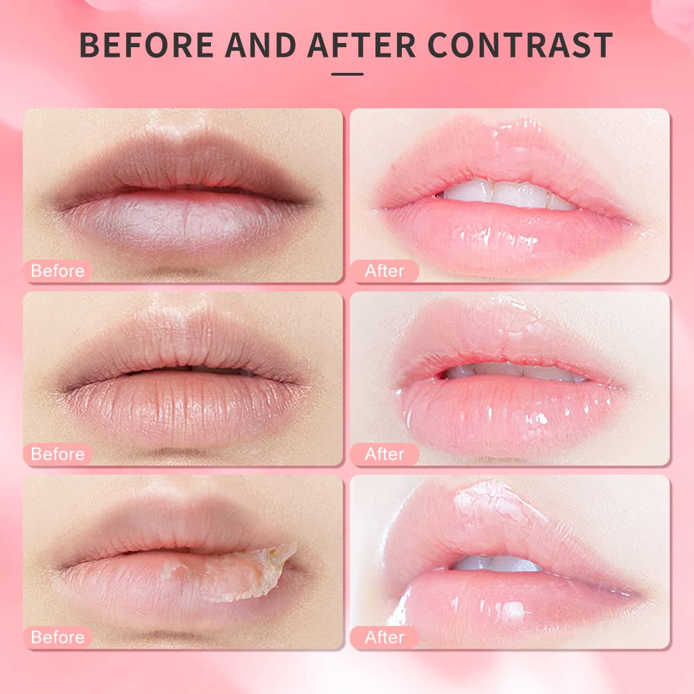 Lip Scrub, Lip Scrubs Exfoliator Moisturizer Dr.YIMAN Sugar Lip Scrub, Lip Exfoliator Scrub for Dry and Chapped Lips,Anti-Aging and Temping, Lip Mask, Lip Care Products, Lip Scrubber, Lip Moisturizer