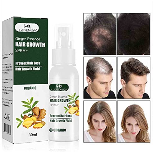 LANEMAY Ginger Essence Hair Growth Spray, Pure Ginger Prevent Hair loss Hair Growth Spray - 30ml