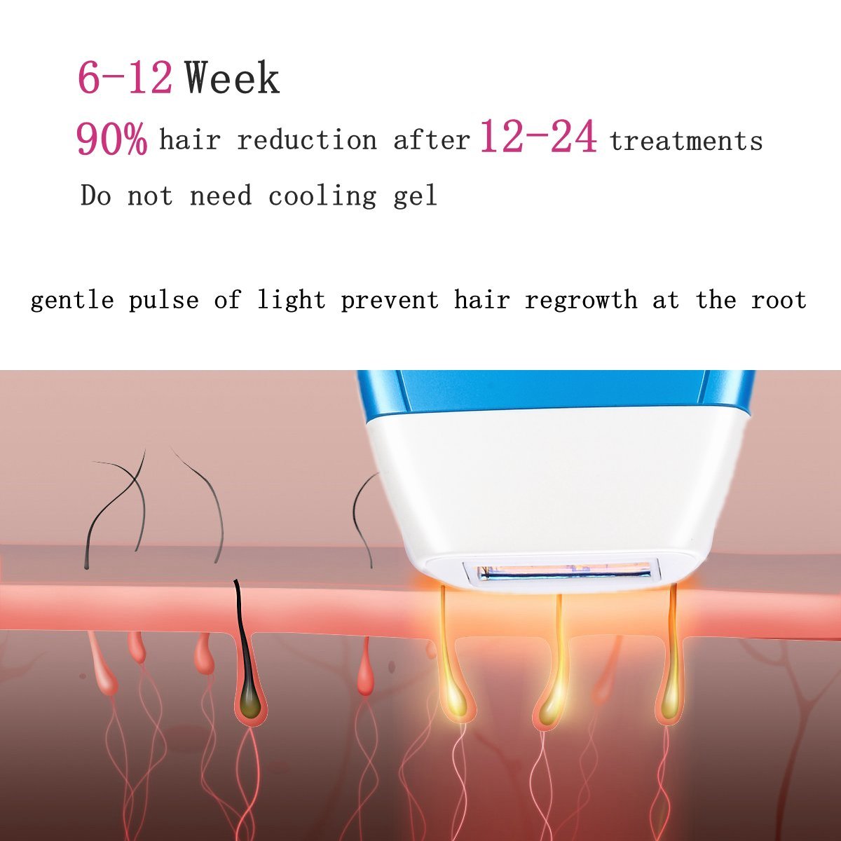 Hair Removal System - TUMAKOU Painless Permanent Hair Removal Device for Women & Man - 400,000 Flashes
