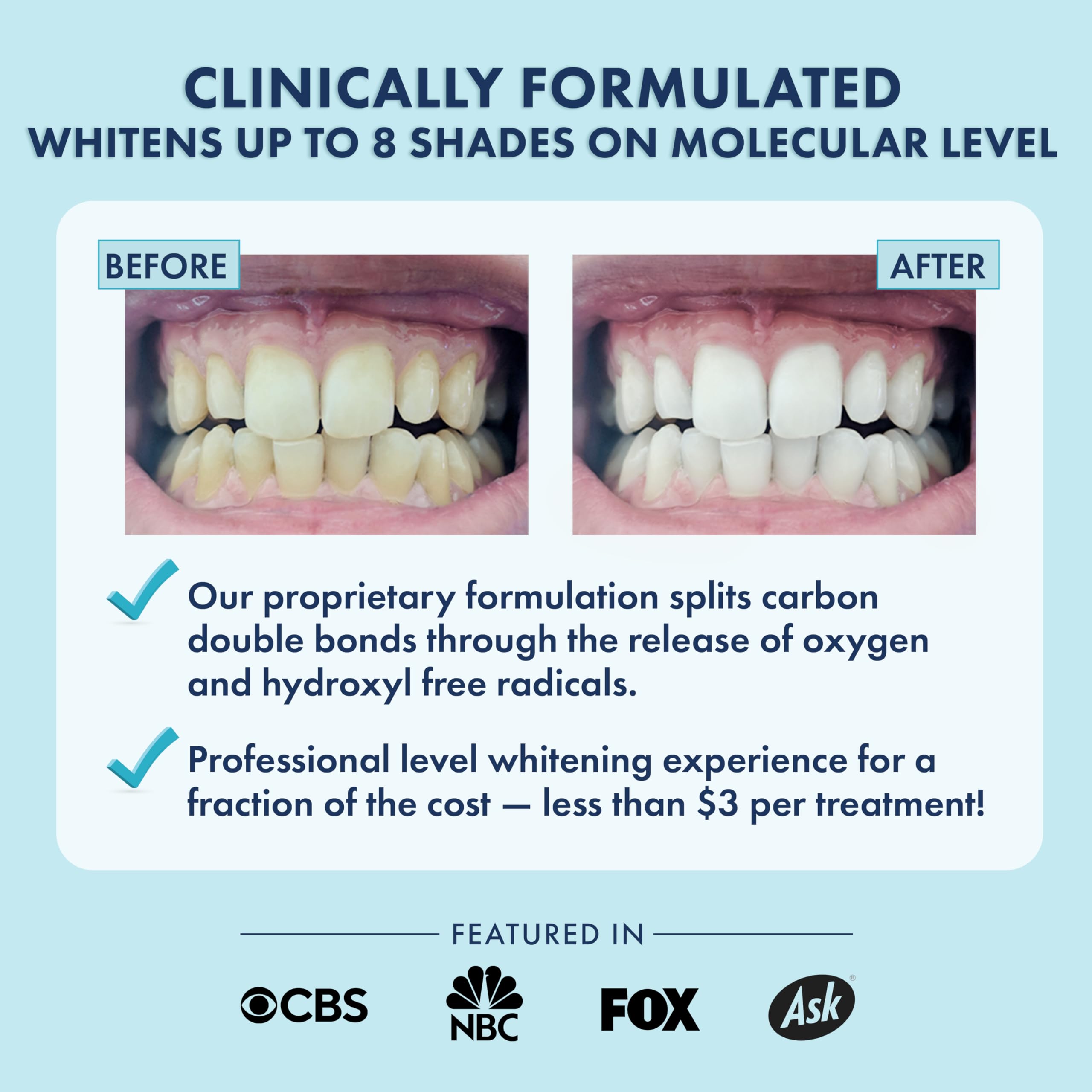 LIVFRESH Teeth Whitening Strips, Results in 14 Days, Cleans Teeth & Reduces Plaque, Enamel Safe, for Sensitive Teeth, Uses Coconut Oil & Hydrogen Peroxide, No Slip Teeth Whitener, 14 Treatments