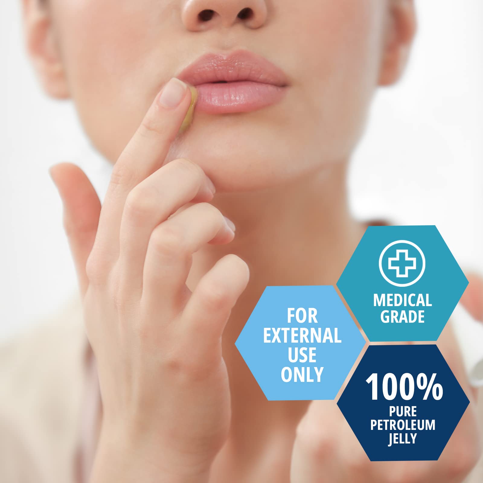 MED PRIDE Pure White Petroleum Jelly Tub 8 OZ - Effective Skin Protectant For Dry Skin, Rashes, Minor Burns & Wounds- Powerful Moisturizer For Chapped Lips, Dry Hands, Chaffed Skin & Diaper Rash