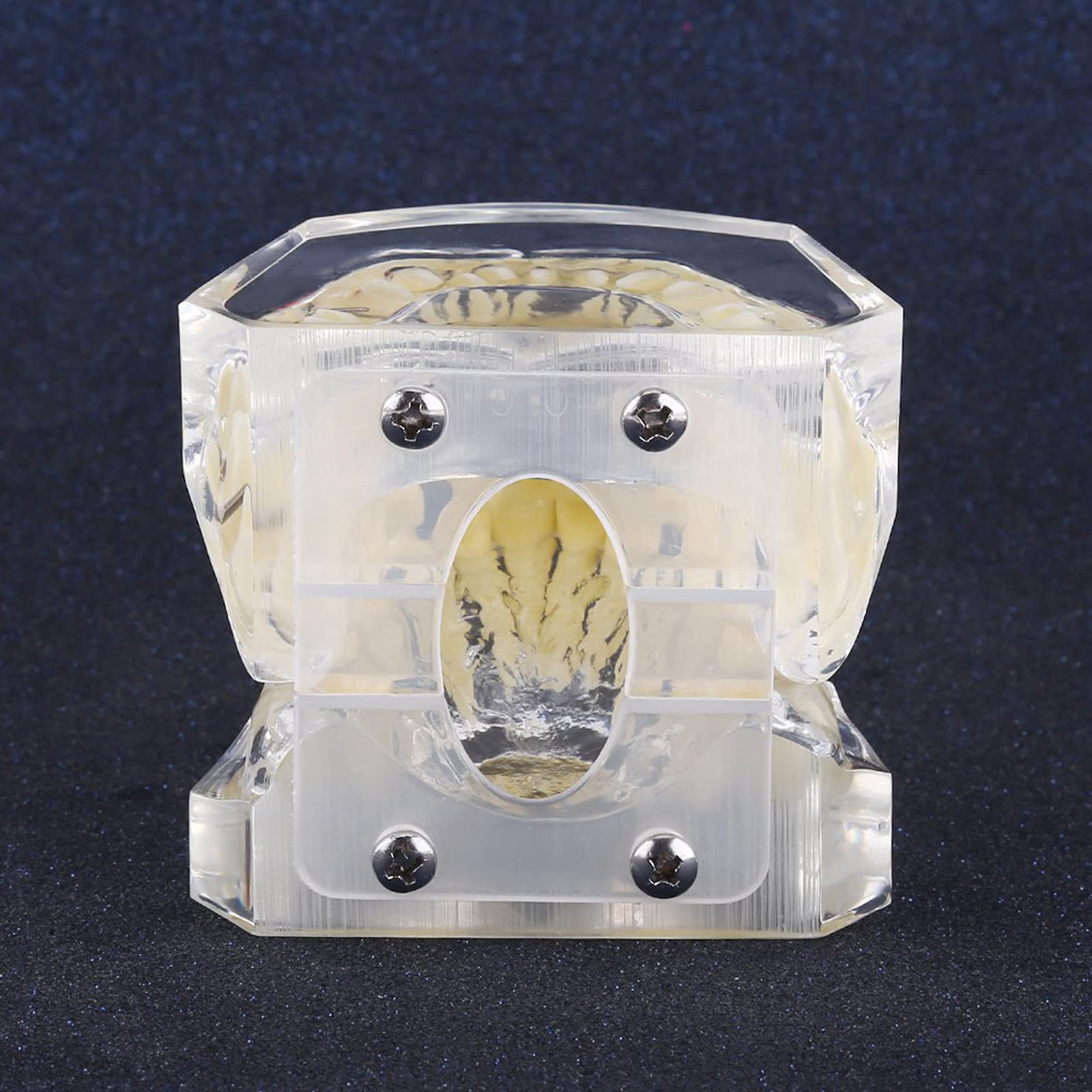 Orthodontic Teeth Model with Metal Brackets and Wires for Adult and Children Malocclusion Study and Braces Demonstration