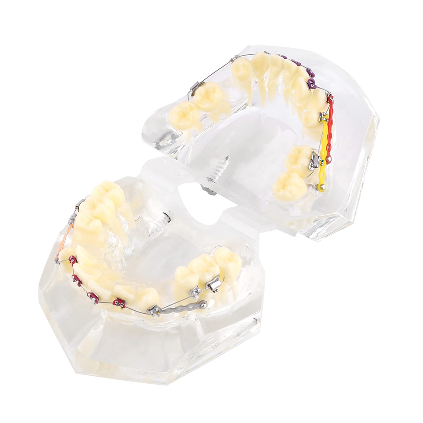 Orthodontic Teeth Model with Metal Brackets and Wires for Adult and Children Malocclusion Study and Braces Demonstration