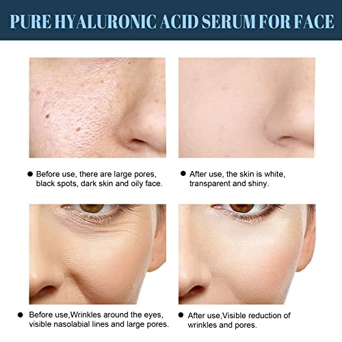 Proform Korean Soluble Protein Thread, Absorbable Collagen Thread for Face Lift, Nano Gold Soluble Protein Thread Strips, Soluble Protein Thread Lifting Instant Face Protein Thread (60PCS)