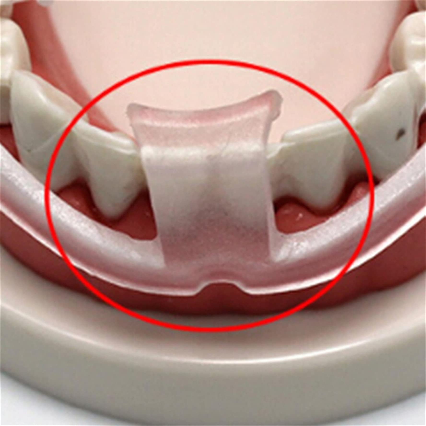 NAGAD Guard for Teeth Clenching Nighttime Mouth Guard Sleep Teeth Guards for Upper and Lower Jaw Transparent Dental Guards, White, 1.77*1.38 Inch, 1.0 Count