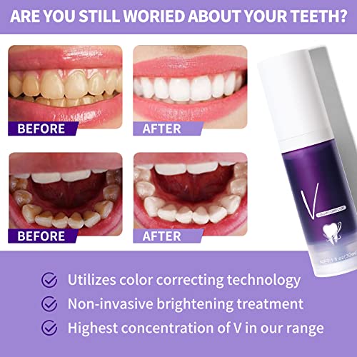 Purple Toothpaste for Teeth Whitening,Tooth Stain Removal,Teeth Whitening Purple Toothpaste, Colour Correcting, Colour Corrector, Tooth Colour Corrector,30ml,2 Pcs