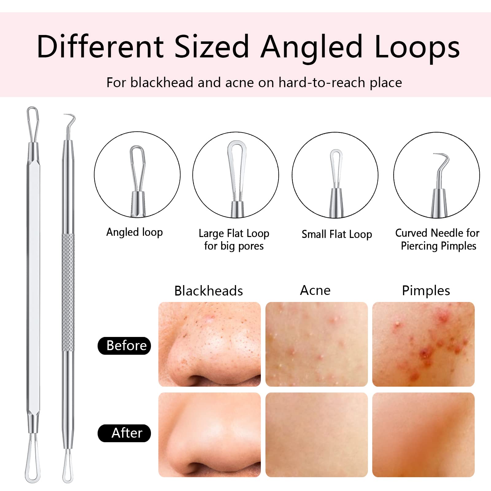 Xesscare Pimple Popper Tool Kit 7 Pcs Blackhead Remover Tool Comedones Tweezers Acne Extractor Blemish Whitehead Removal Tool for Facial, Nose and Forehead (Silver)