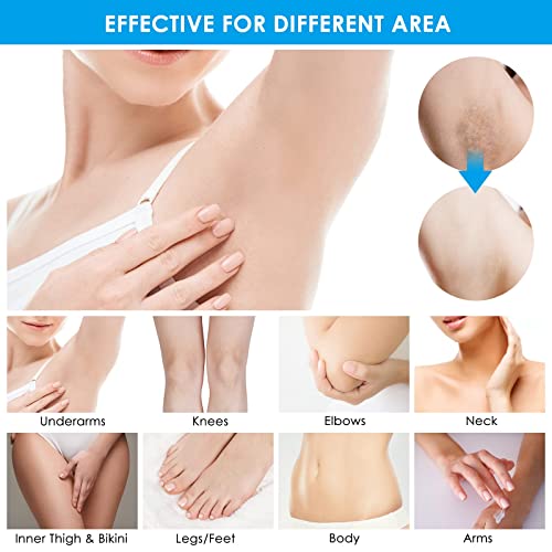 H-BDAY Acanthosis Nigricans Therapy Cream,Dark Spot Remover For Body,Dark Spot Corrector Cream,Neck-New Formula