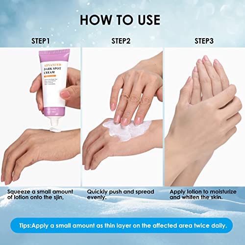 H-BDAY Acanthosis Nigricans Therapy Cream,Dark Spot Remover For Body,Dark Spot Corrector Cream,Neck-New Formula