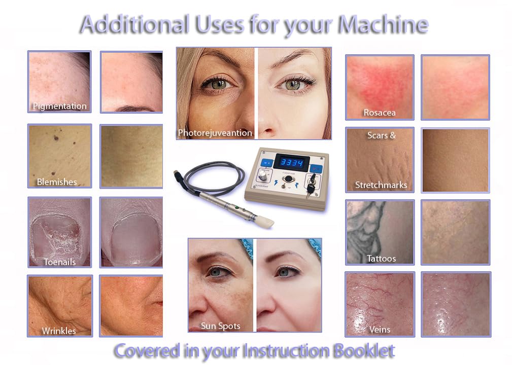 Home Salon Scar & Stretch Mark Removal Machine System.