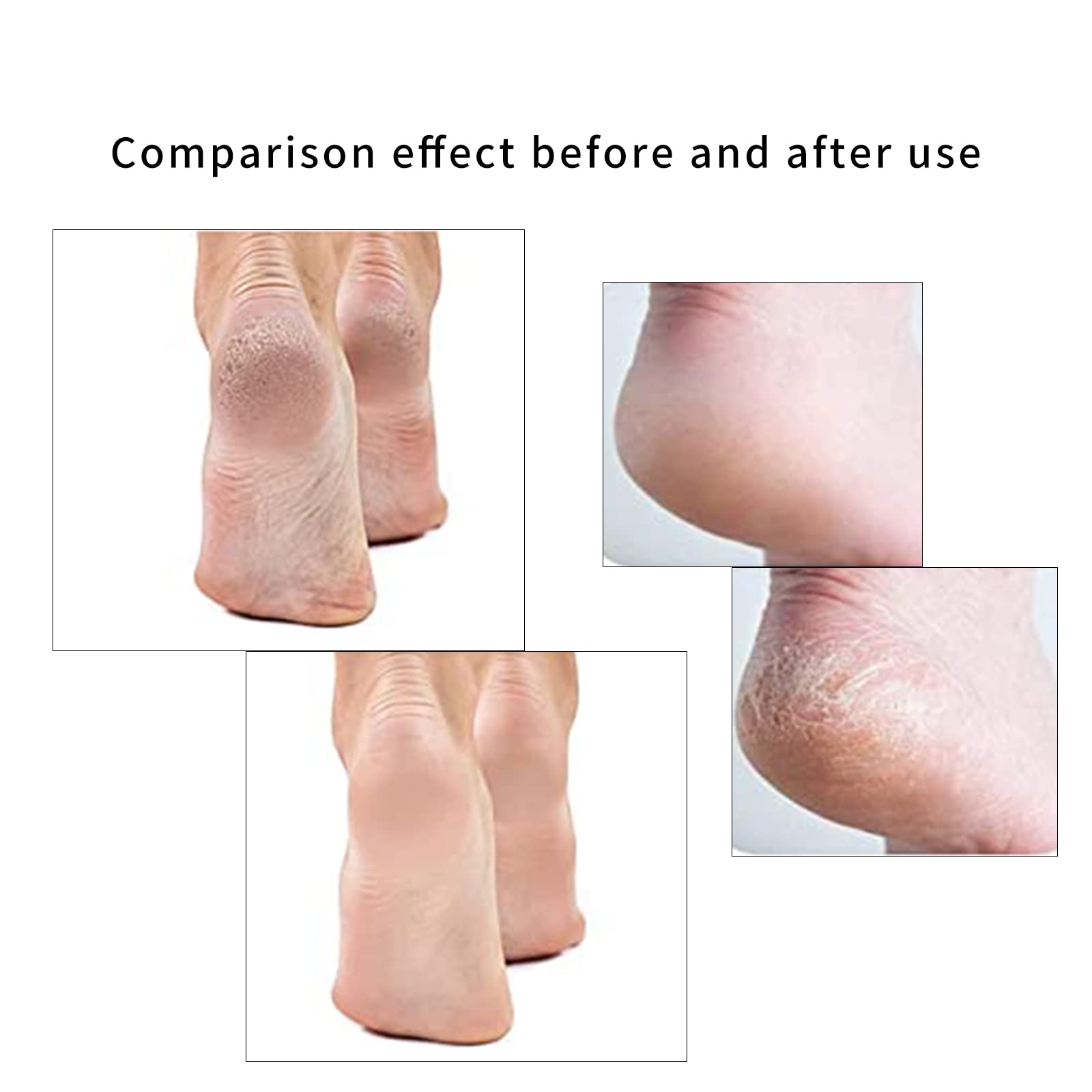 Pedicures Replacement Heads, Flawless Pedicures Electric Tool Electric Foot Grinder Replacement Head-3 Black&3 Gray