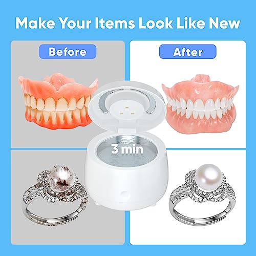 WPDGAD Ultrasonic UV Cleaner for Dentures, 30W Professional Ultrasonic Cleaner Machine for all Dental, Retainer, Aligner, Braces, Mouth Guards, Toothbrush Head, Shaver Head, Jewelry, White