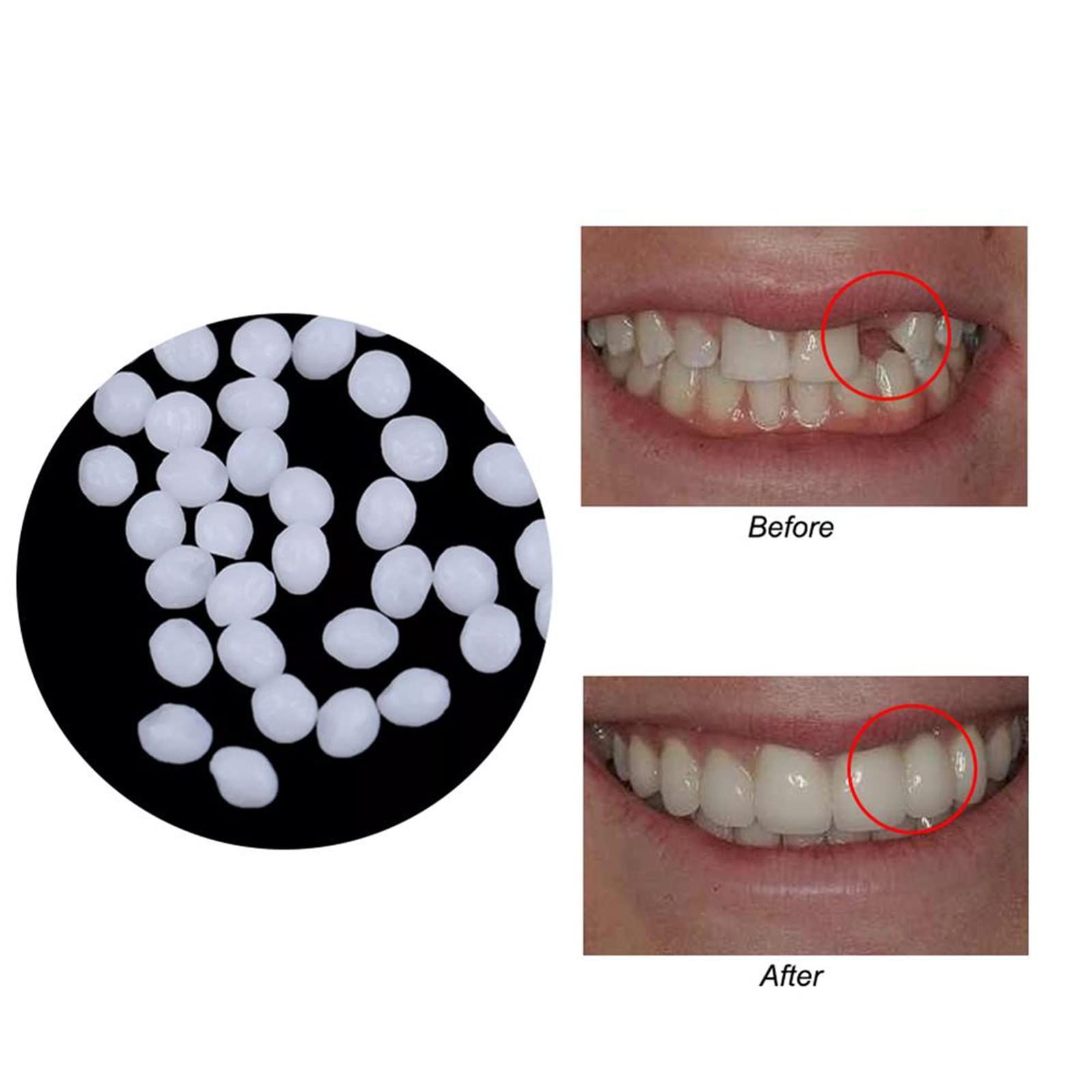 LTQUS Temporary Tooth Repair Beads-Teeth Repair Kit, Moldable False Teeth, Thermal Fitting Beads for Missing Dental Filling Material with Broken Teeth(30g)