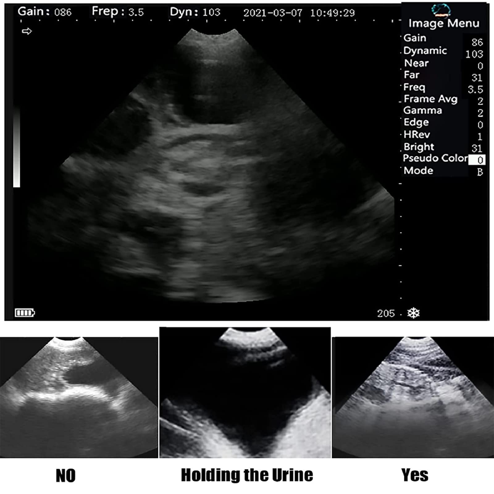 Pregnancy Test Ultrasound Scanner Veterinary Machine Portable B-Ultra Sound Scanner Farm Animals Pregnancy Mechanical Sector scanning Probe for Sheep, Pig Pregnancy Test