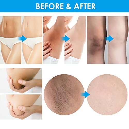 H-BDAY Acanthosis Nigricans Therapy Cream,Dark Spot Remover For Body,Dark Spot Corrector Cream,Neck-New Formula