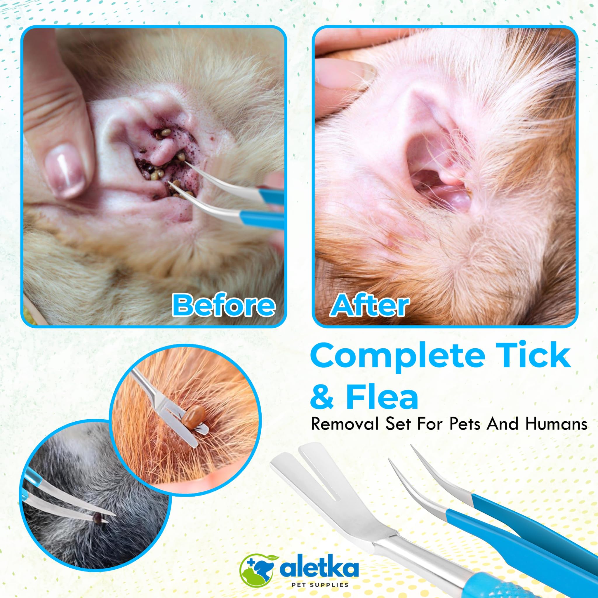 Tick Removal Tool Kit with Precision Tweezers • Dogs • Cats • Kittens • Puppies • People • Custom Design Removes Whole Tick • Durable Stainless Steel • Dishwasher Safe • Easy Use • Hiking • Gift Idea