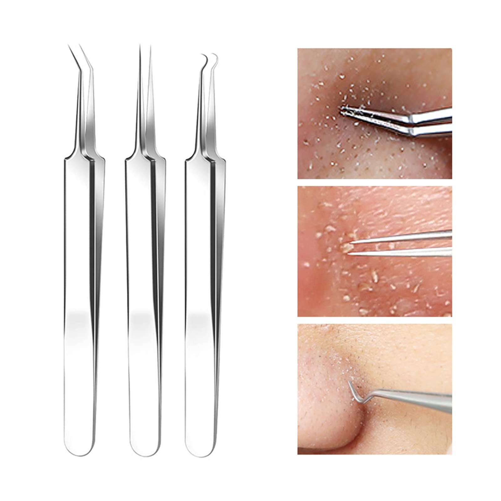 Pimple Popper Tool Kit, Blackhead Remover Tools, Extraction Tools for Estheticians, Black Head Extractions Tool Professional, Comedone Extractor, Beauty Acne Removal Blemish Set with Metal Case(15PCS)