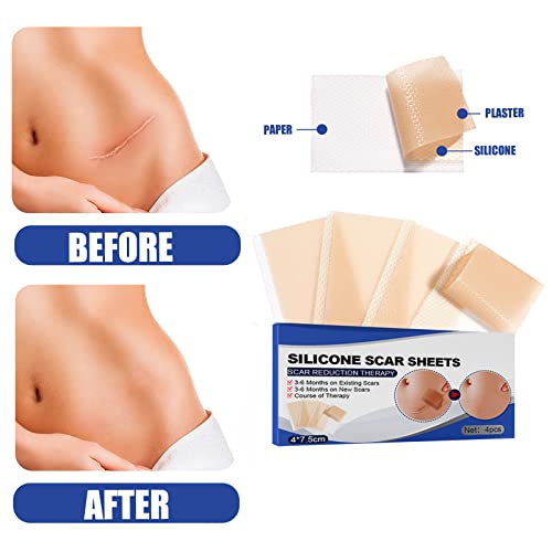 Pore Strips Silicone Gel Scar Patch Fades Stretch Marks Burn Scar Patch Smooth Skin Skin Cut Fix Patch Mens Face Moisturizer