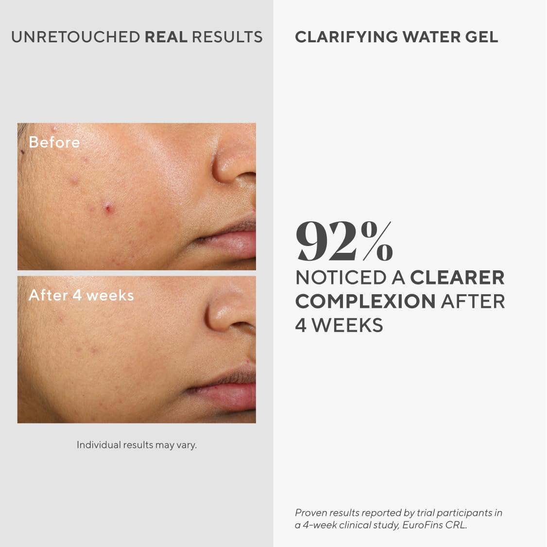 Murad Clarifying Water Gel - Non-Comedogenic Light Gel Moisturizer for Face, Neck & Chest - Facial Skin Care Product Hydrates with Non-Greasy Finish, 2 Fl Oz