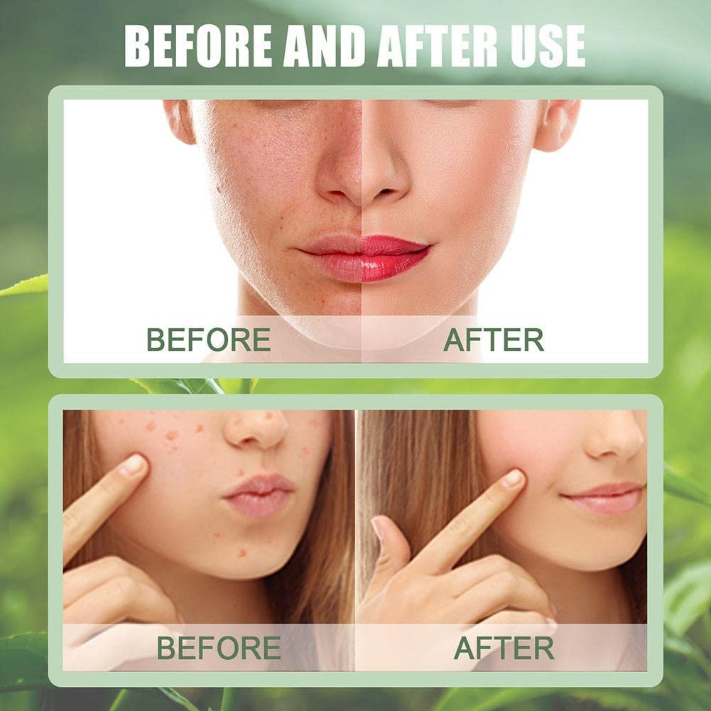 Oneews Green Tea Mask Stick, Green Tea Deep Cleanse Mask Atheniz Blackhead Remover, Natural Green Tea Deep Cleanse Mask Stick For All Kind Skin Type (1Pack)