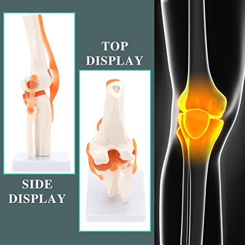 RONTEN Anatomical Knee Model, Flexible 1:1 Scientific Life Size Human Knee Model with Ligament, Teaching Tool for for Doctors Office Educational Anatomy Tool