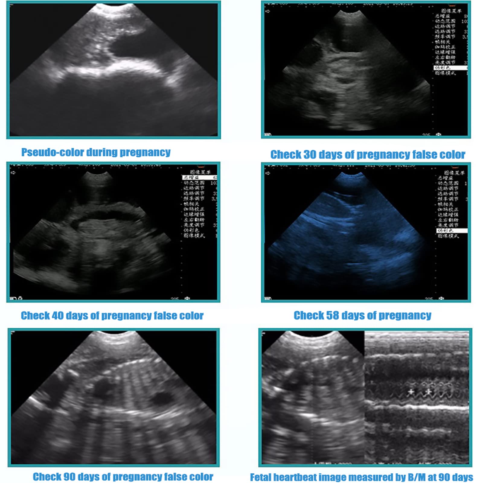Pregnancy Test Ultrasound Scanner Veterinary Machine Portable B-Ultra Sound Scanner Farm Animals Pregnancy Mechanical Sector scanning Probe for Sheep, Pig Pregnancy Test