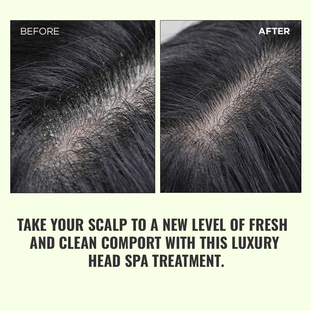 Rated Green Real Mary Exfoliating and Nourishing Scalp Pack Bundle - Deep Cleans, Refreshes, For All Hair Types, Especially Oily Tresses