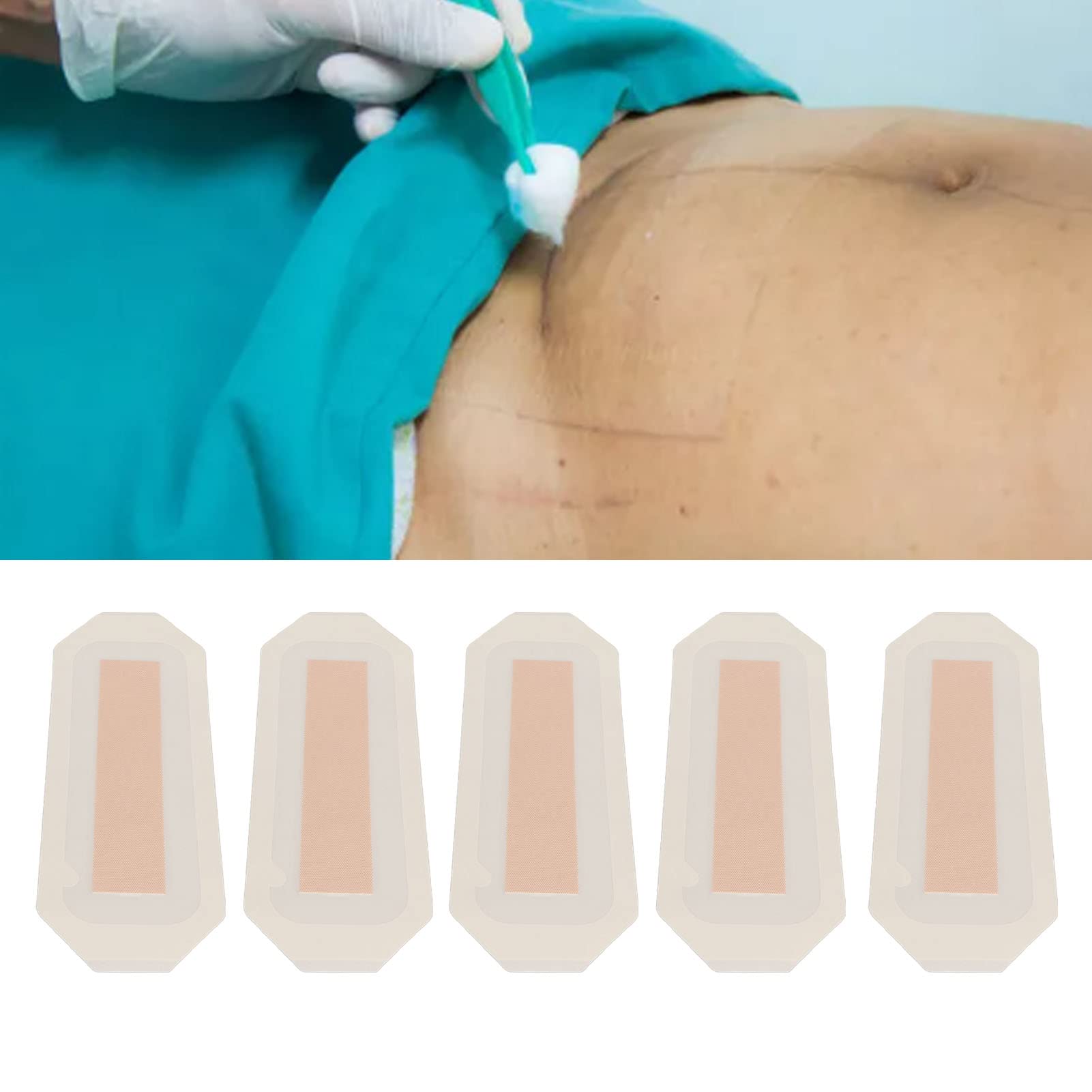 Pwshymi Scar Tape, Scar Sheets Full Coverage Waterproof Breathable 5pcs for Bathing for Maternity
