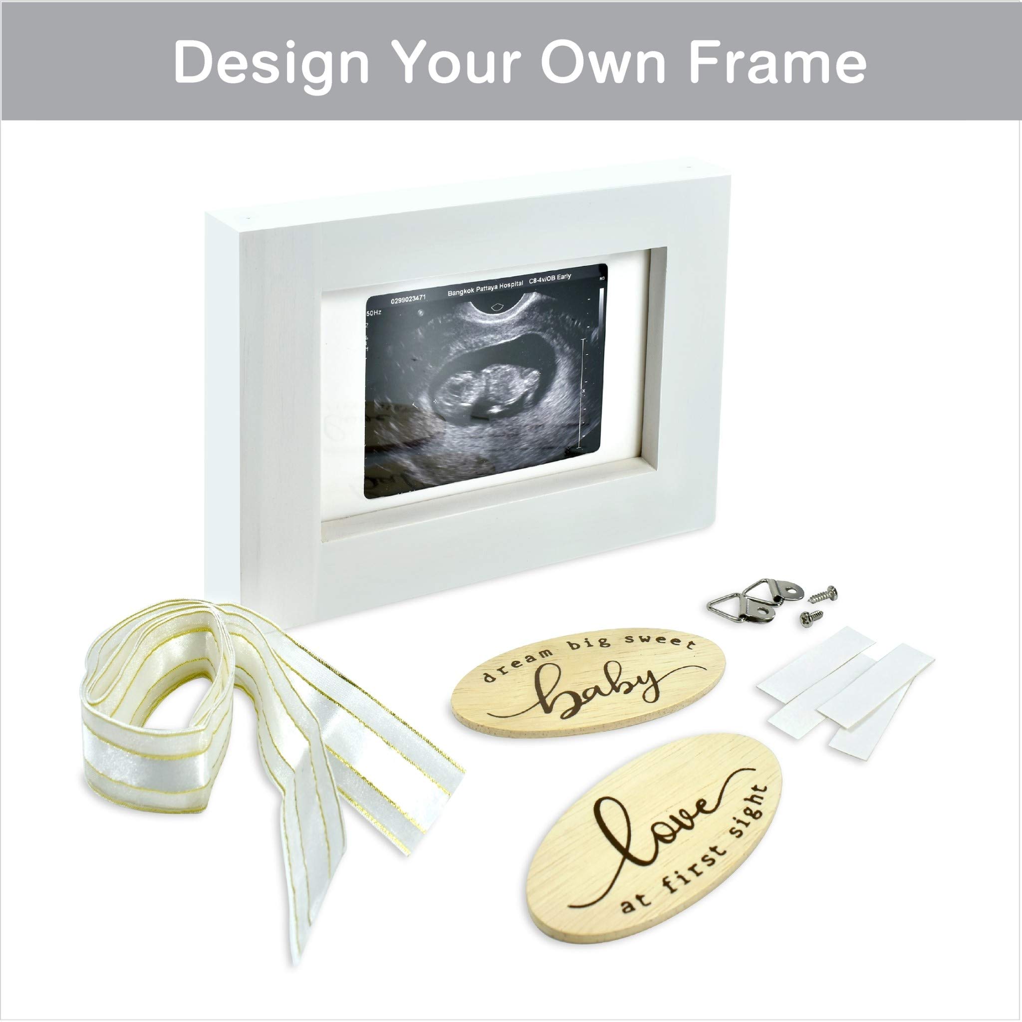 I’m Solid Wood Sonogram Pregnancy Baby Ultrasound 2 Sided Photo Frame, Great for Expecting New Parents Keepsake & Nursery Décor “Love at First Sight/Dream Big Sweet Baby" (White)
