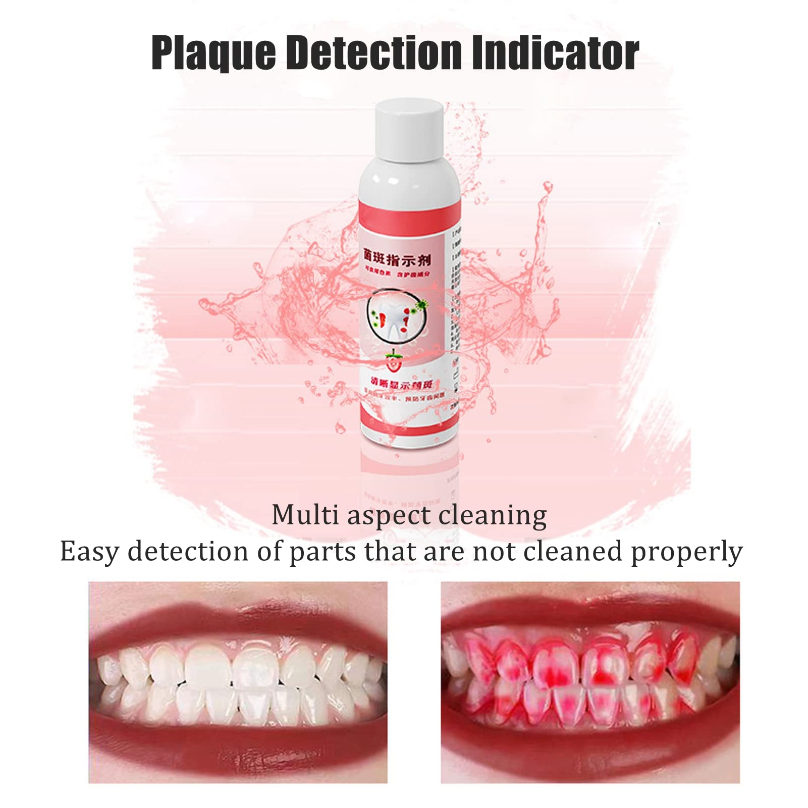 Plaque Disclosing Agent, 60ml Dental Plaque Indicator with Scale Cup, Oral Tartar Test Examination for Kids or Adults Teeth, Plaque Identifying, Care About Your Dental Hygiene