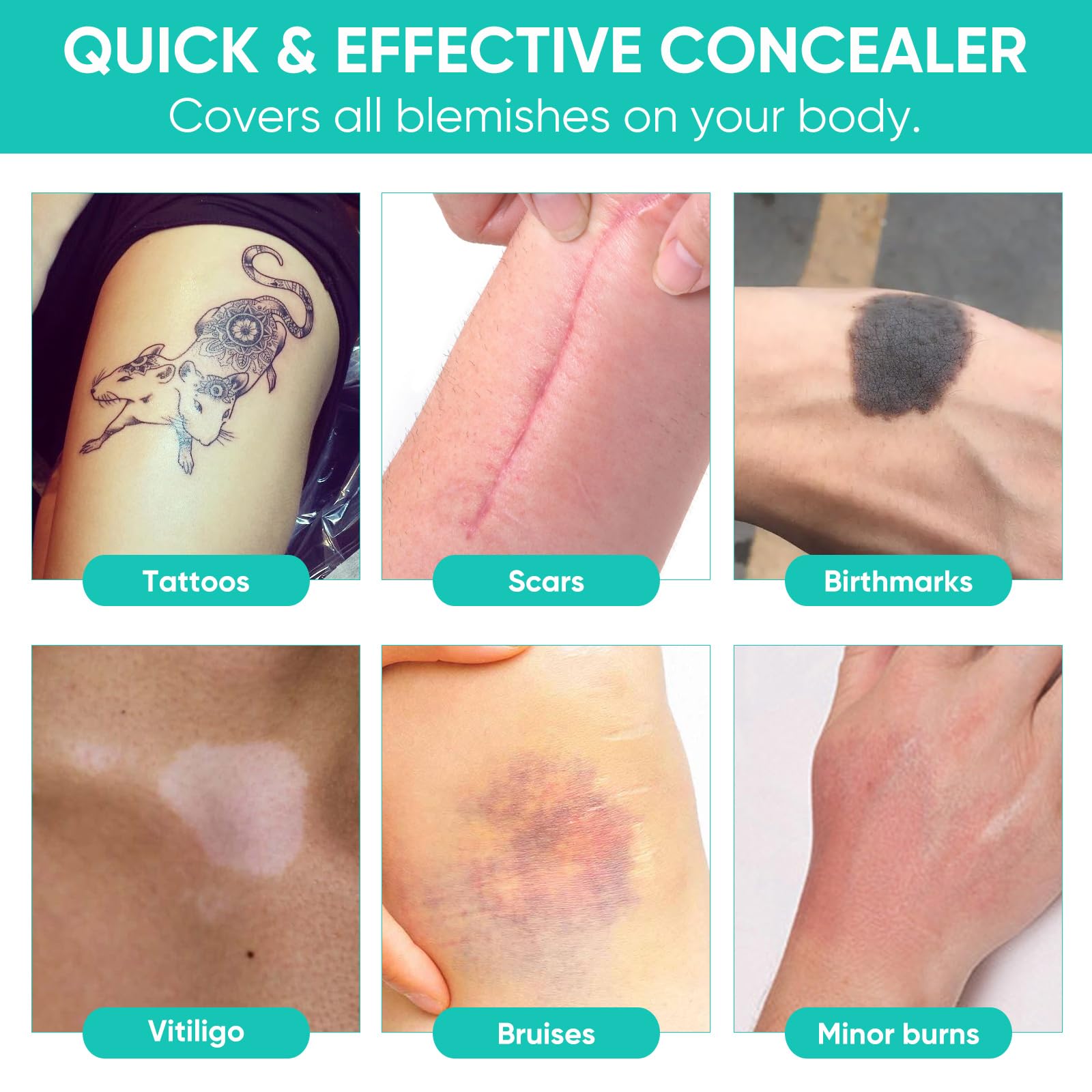 iTecFreely Tattoo-Cover-Up Waterproof-Sweatproof-Tattoo-Cover-Up-Tape Ultra-Thin-Breathable-Invisible-Patch-Concealer-Sticker-Suitable-for-Spot-and-Scar