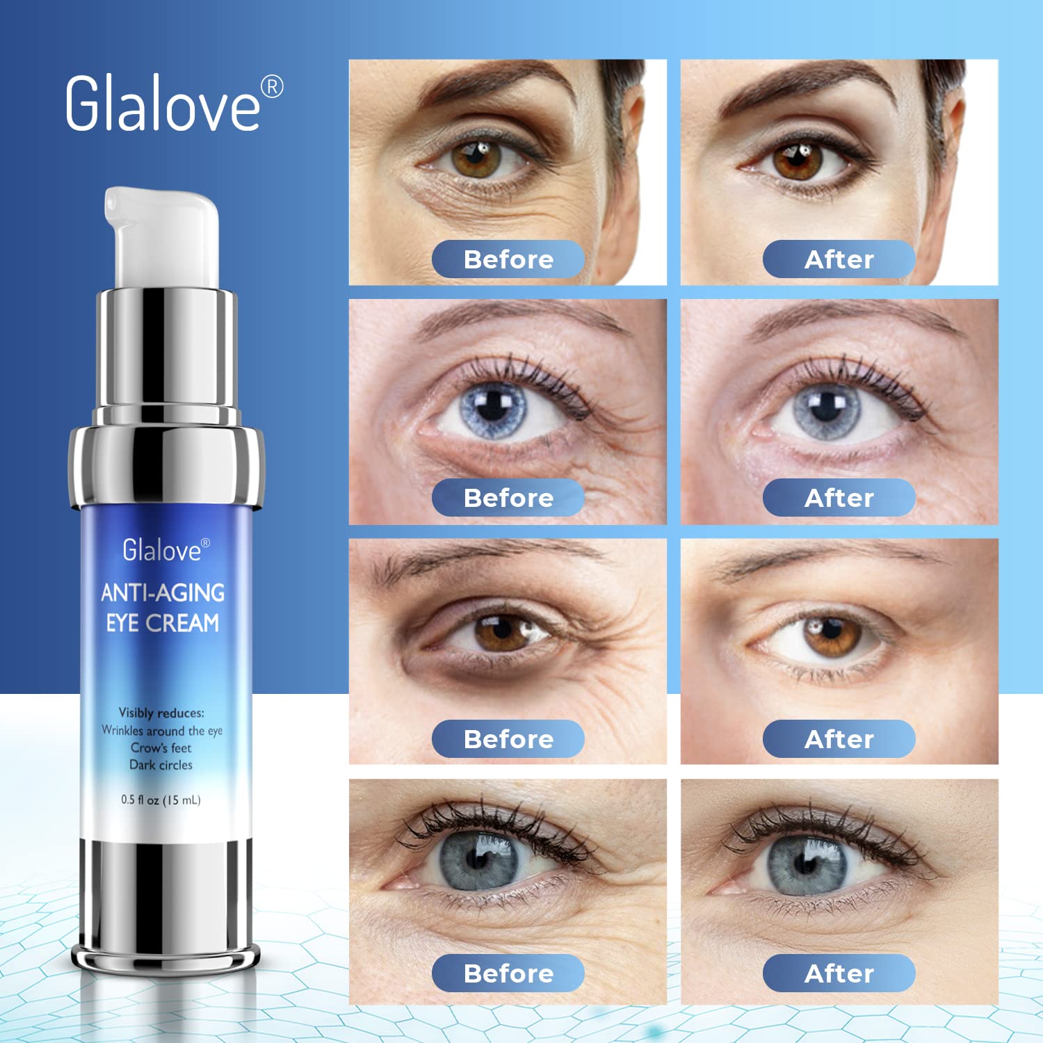 Retinol Eye Cream for Bags, Wrinkles & Puffiness - 15ML Anti-Aging Dark Circle Serum