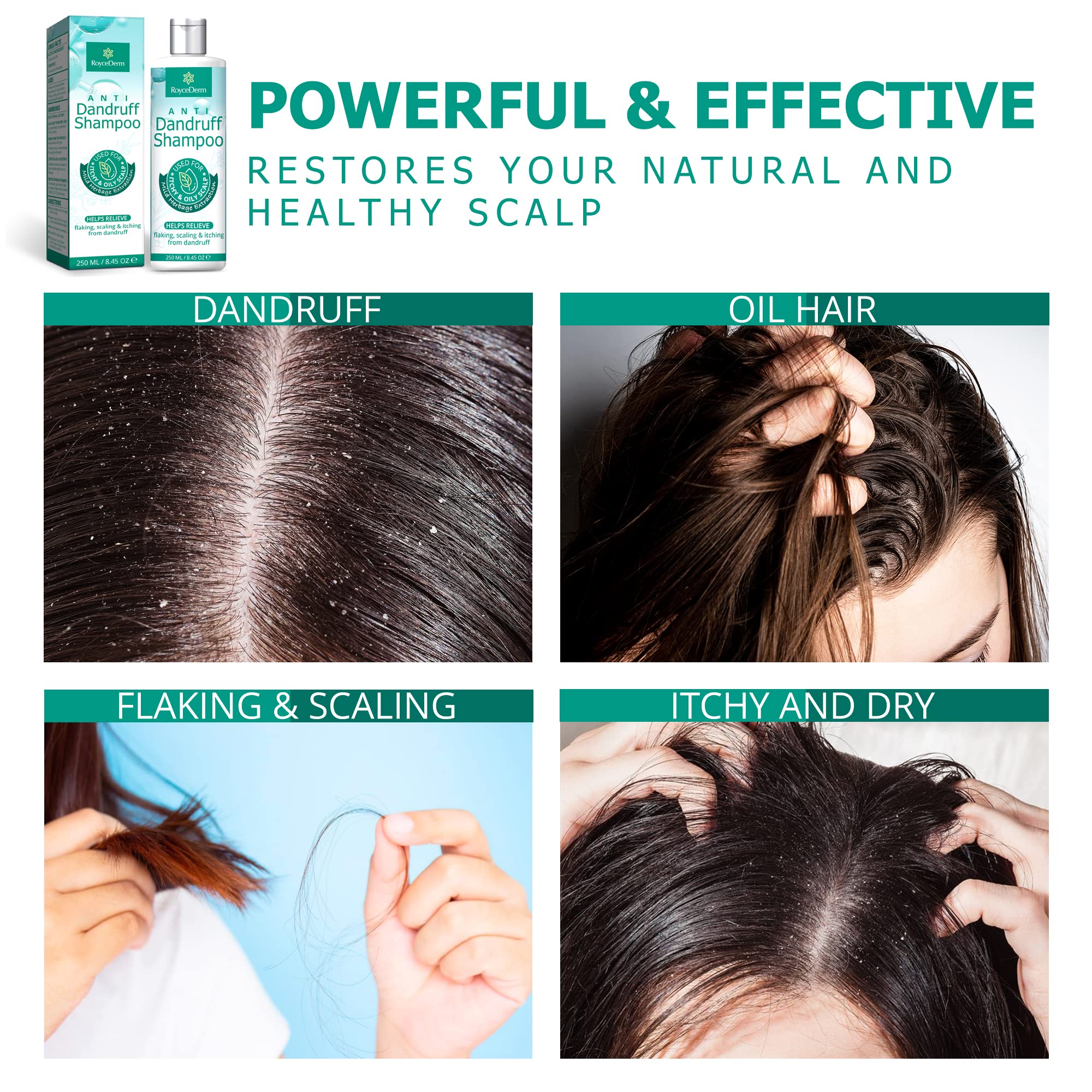 Roycederm Anti-Dandruff Shampoo - Oily Hair and Dry Scalp Treatment for Fast Relief from Flakiness and Itchiness