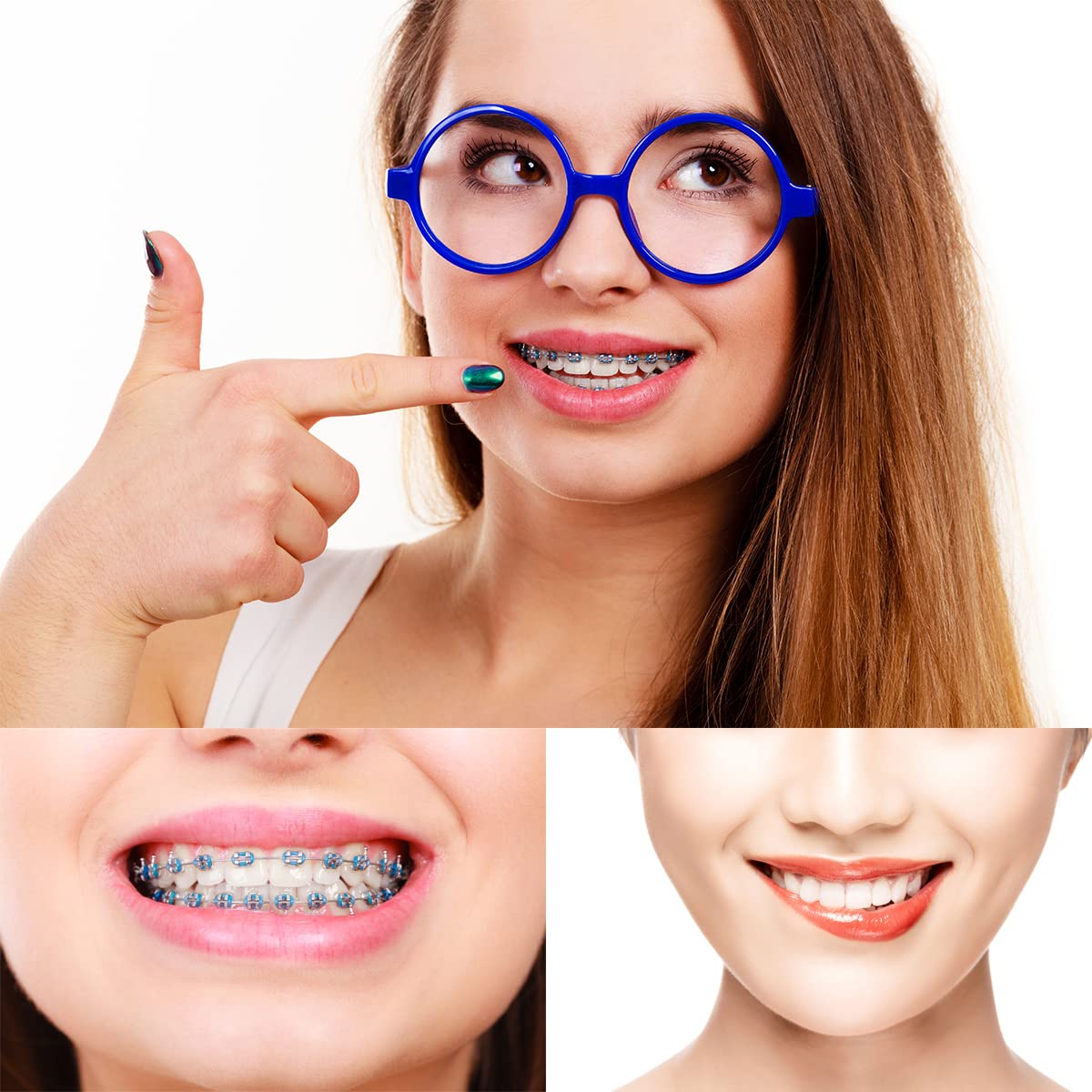 Rubber Bands for Braces, 1040 Pcs Color Orthodontic Ligature Ties O-Rings Elastic Braces Rubber Bands
