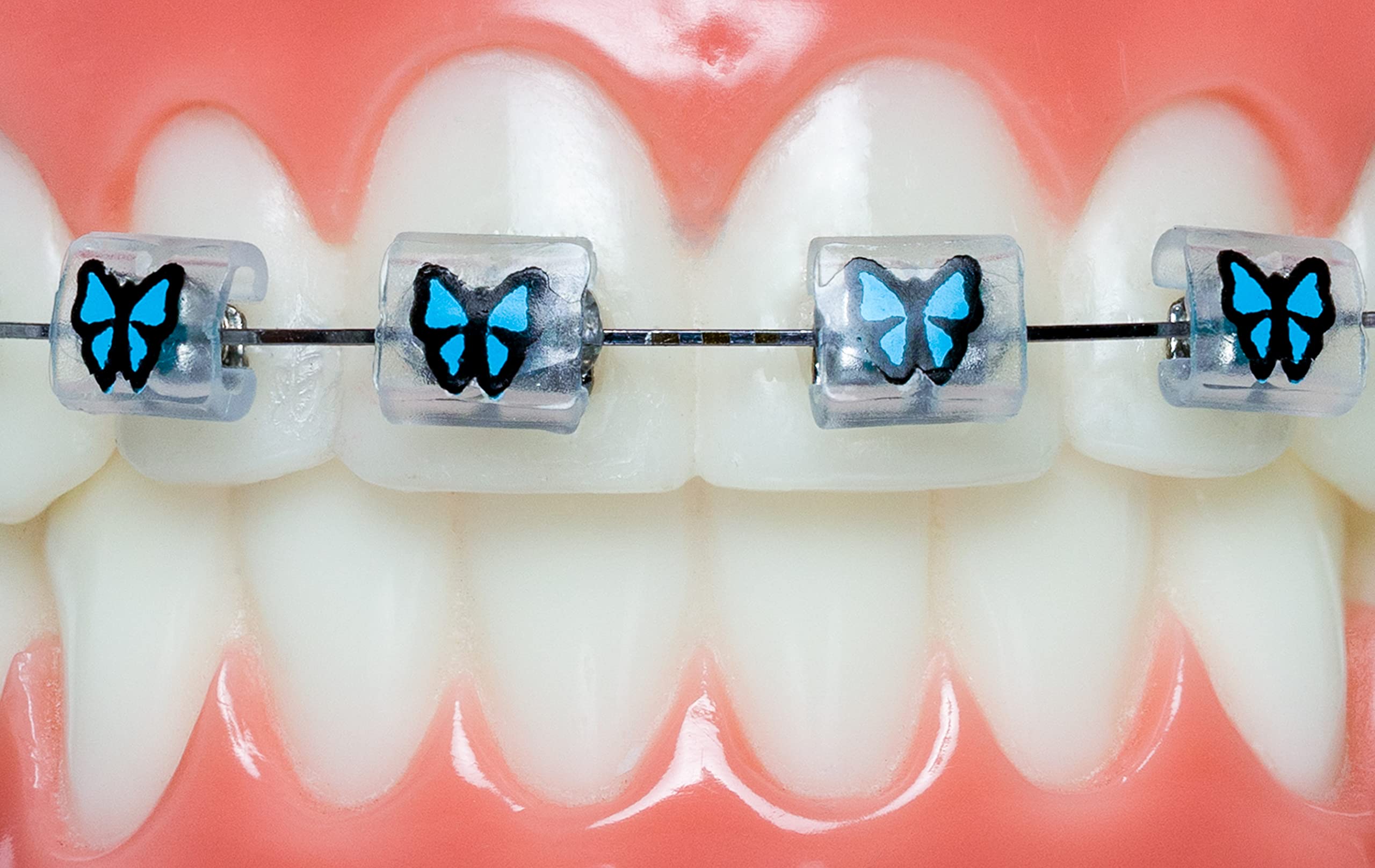 Snapcaps Braces Bumper Cover, Orthodontic Bracket Wax Substitute, Alternative Snap-on Braces Guard Braces Accessories 10 pack (Butterfly)