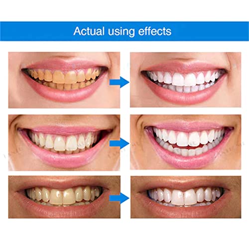 Store Belly Teeth Whitening Essence, Teeth Whitening Essence Pen, Teeth Whitening Gel, Teeth Whitening Kit, Fast and Effective Removal Tooth Stain Removal