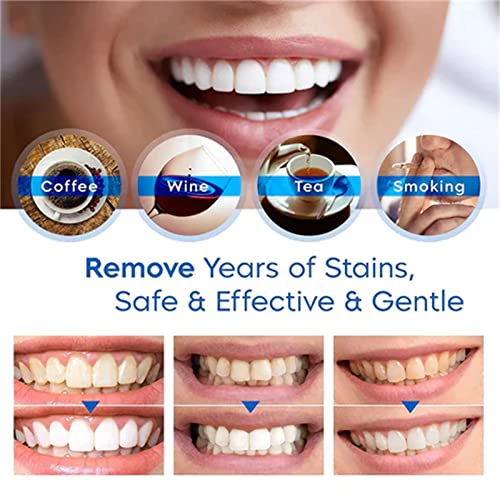Store Belly Teeth Whitening Essence, Teeth Whitening Essence Pen, Teeth Whitening Gel, Teeth Whitening Kit, Fast and Effective Removal Tooth Stain Removal