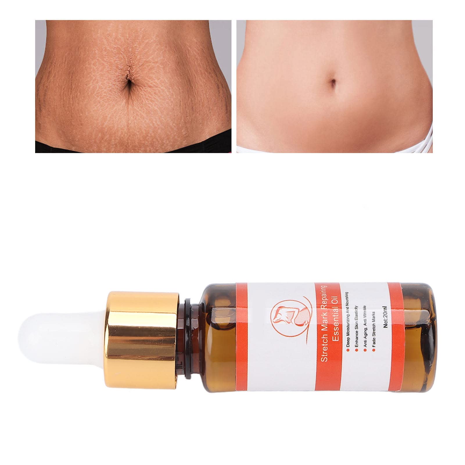Stretch Marks Repair Essential Oil, Improve Skin Elasticity Pregnancy Care Essential Oil
