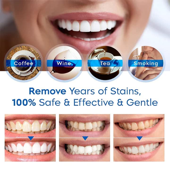 Teeth Whitening Essence, Teeth Whitening Essence Pen,Intensive Stain Removal Teeth Reduce Yellowing