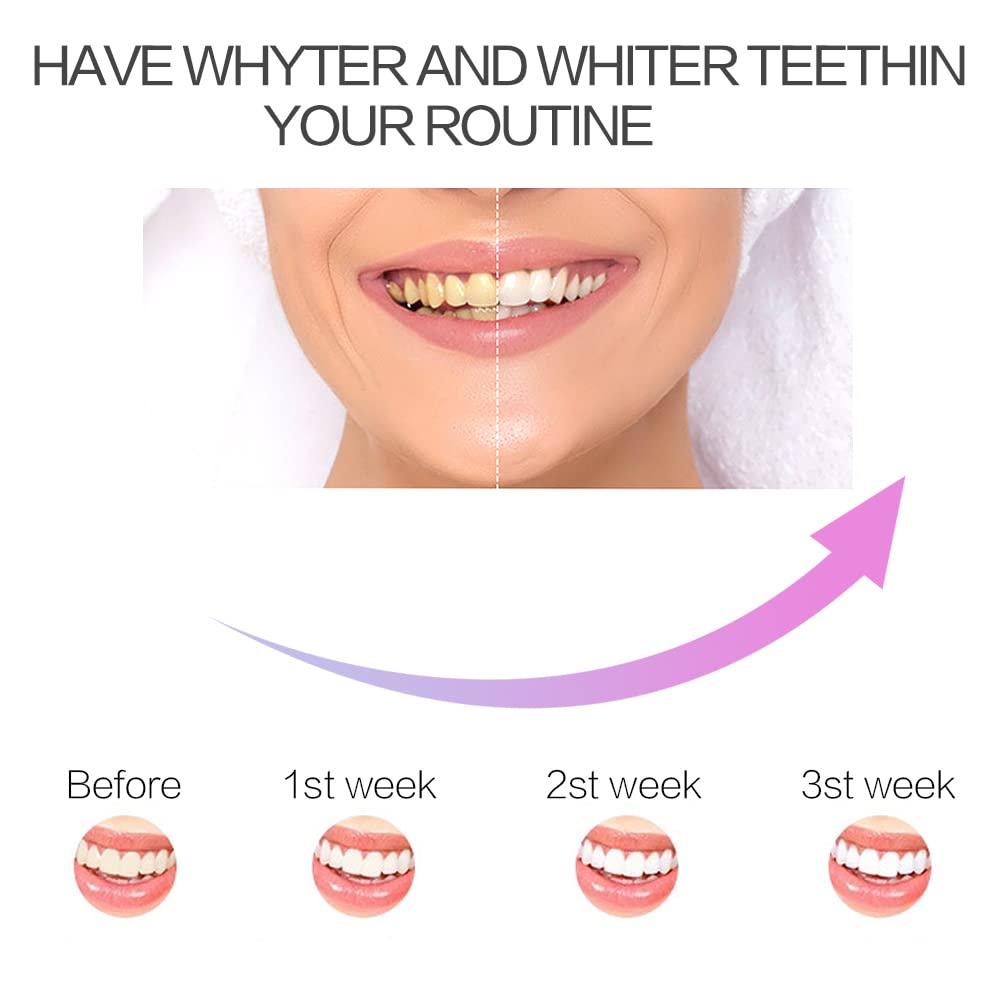 Teeth Whitening Strips Black Strips for Non-Sensitive Professional Effect Teeth Whitening Non-irritating Non-Peroxide Ingredients of 28 Whitener Strips (14 Treatments) (Mint)