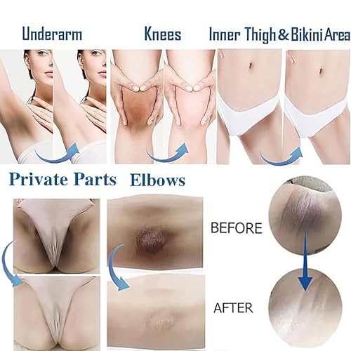 Skin Lightening Cream For Dark Underarm , Knees , Elbows , Inner Thigh , Bikini Line , Armpit Area Bleaching cream,Permanent Whitening No Rebound , Spot Remover Lighten Body Black Designed by USA