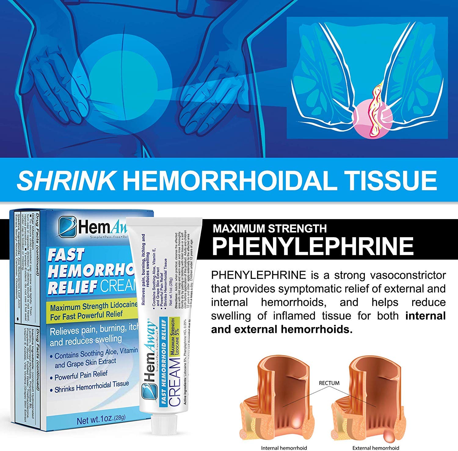 HemAway Hemorrhoid Relief Cream, Patented hemorrhoid Cream with 5% Lidocaine