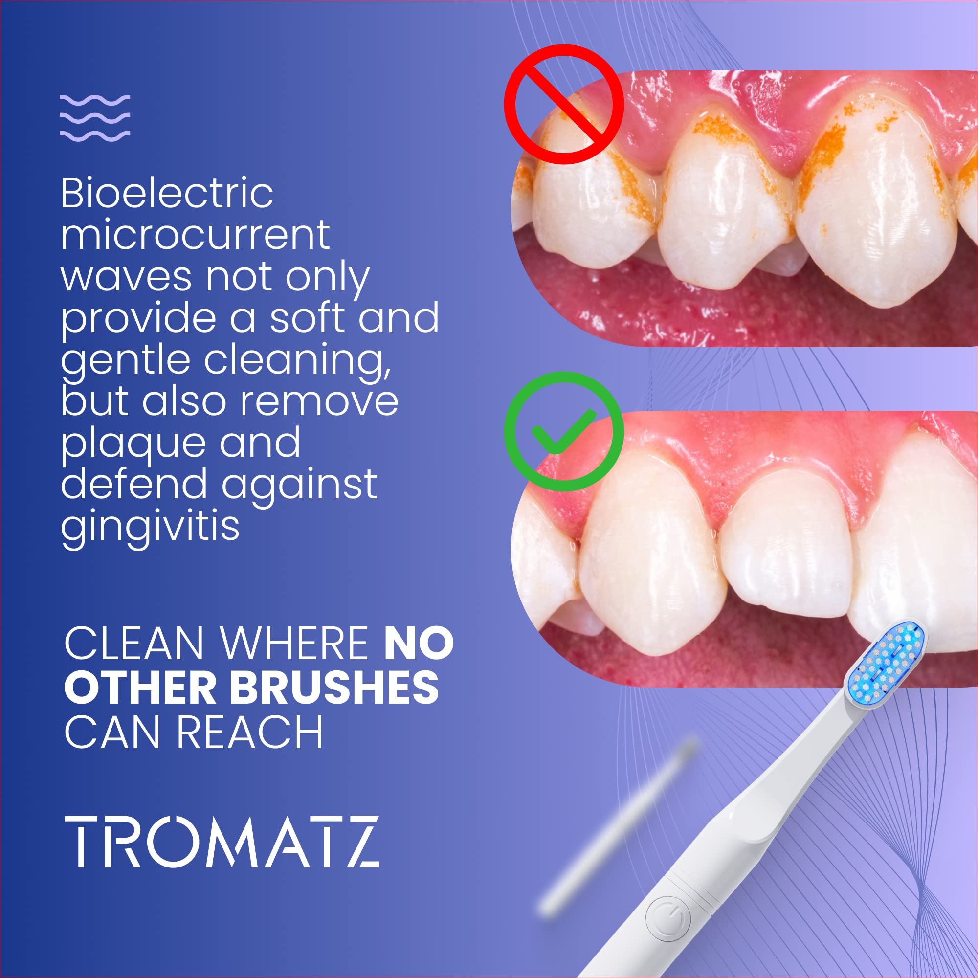 Tromatz Simple Battery Powered Toothbrush for Adults and Kids - Bioelectric Microcurrent Wave - Non-Replaceable Brush Head and Battery - No Vibration, Soundless, Waterproof - Blue