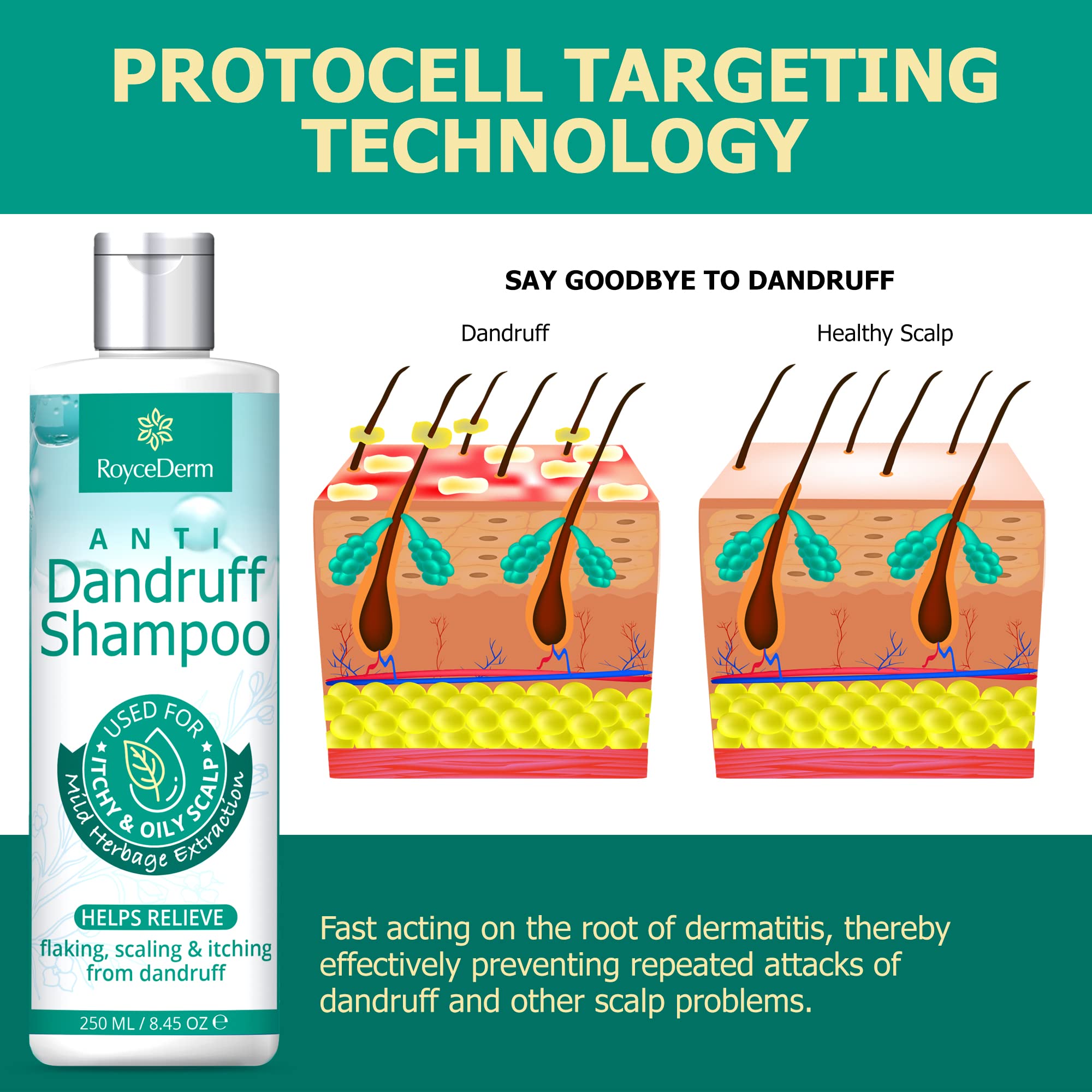 Roycederm Anti-Dandruff Shampoo - Oily Hair and Dry Scalp Treatment for Fast Relief from Flakiness and Itchiness
