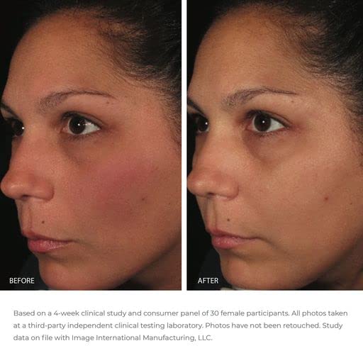 IMAGE Skincare ORMEDIC Balancing Antioxidant Serum 1 fl oz.